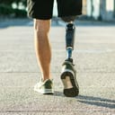 amputate (【Verb】to remove a limb or body part in a medical operation ...
