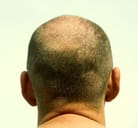 bald (【Adjective】) Meaning, Usage, and Readings | Engoo Words