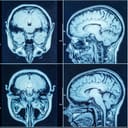 cure (【Noun】a medication used to treat an illness ) Meaning, Usage, and ...