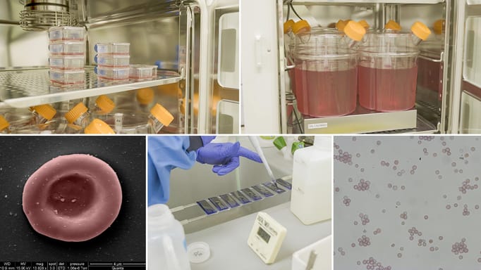 Lab-Grown Blood Used in First Human Trial | Engoo Daily News