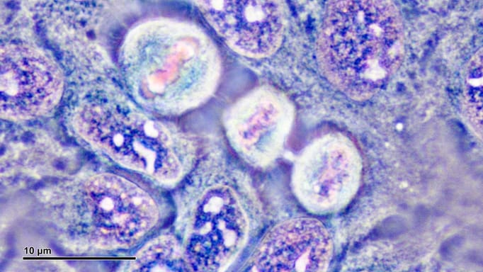 Henrietta Lacks: The Cells that Changed the World | Engoo 每日新闻