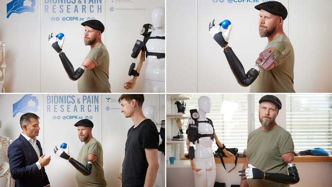 Man Can Move Every Finger on New Bionic Arm | Engoo Daily News