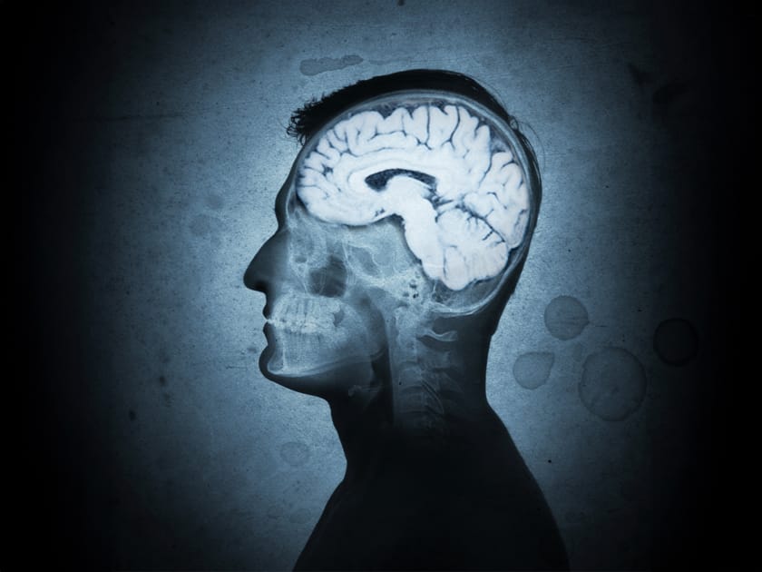 What Is Procedural Memory? | Engoo